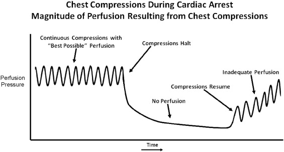 Why do humans (but not turtles) benefit from rapid chest compressions ...