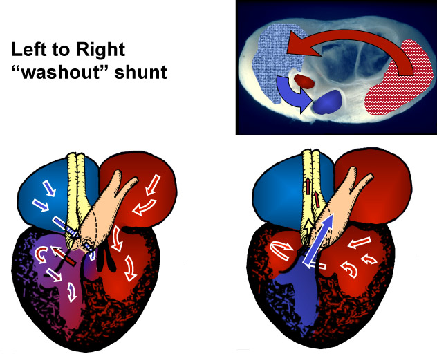 Why do humans (but not turtles) benefit from rapid chest compressions ...